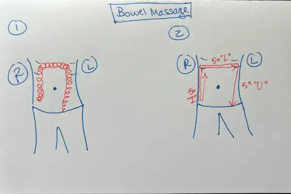 Treating & Preventing Constipation | Pelvic Health Support